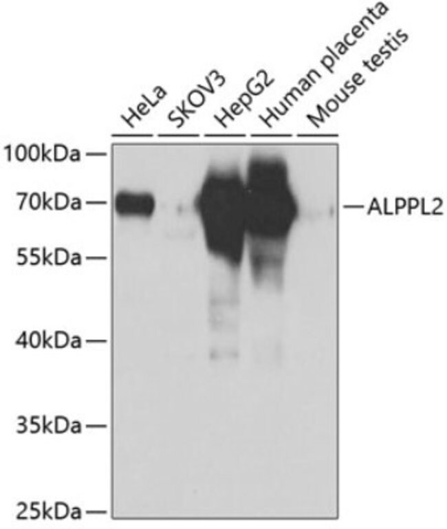 ALPPL2 Rabbit anti-Human, Mouse, Polyclonal, Novus Biologicals 100 μg; | Fisher Scientific